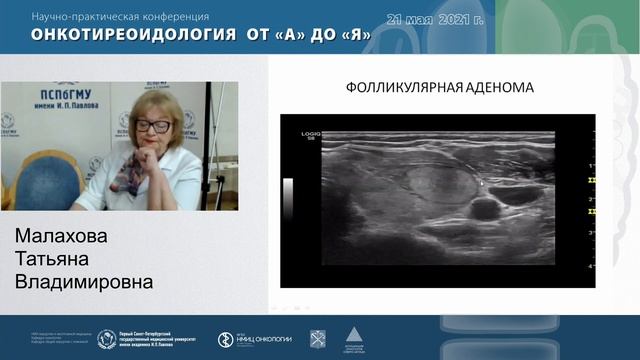 Лекция: «Ультразвуковая диагностика ВДРЩЖ»