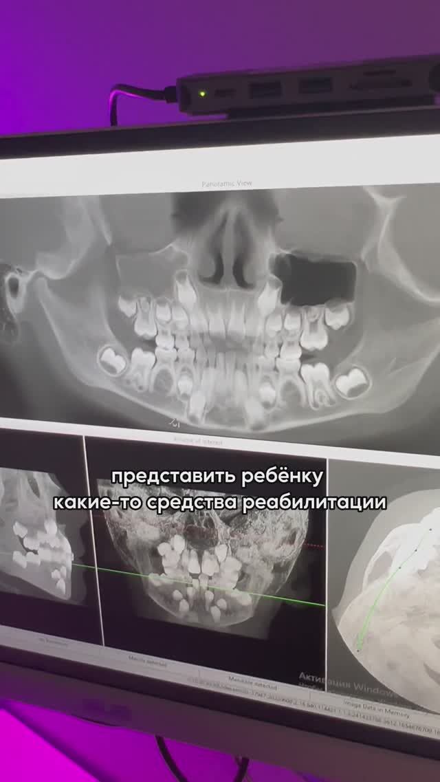 Зачем компьютерная томография (КТ) детям? Это безопасно?