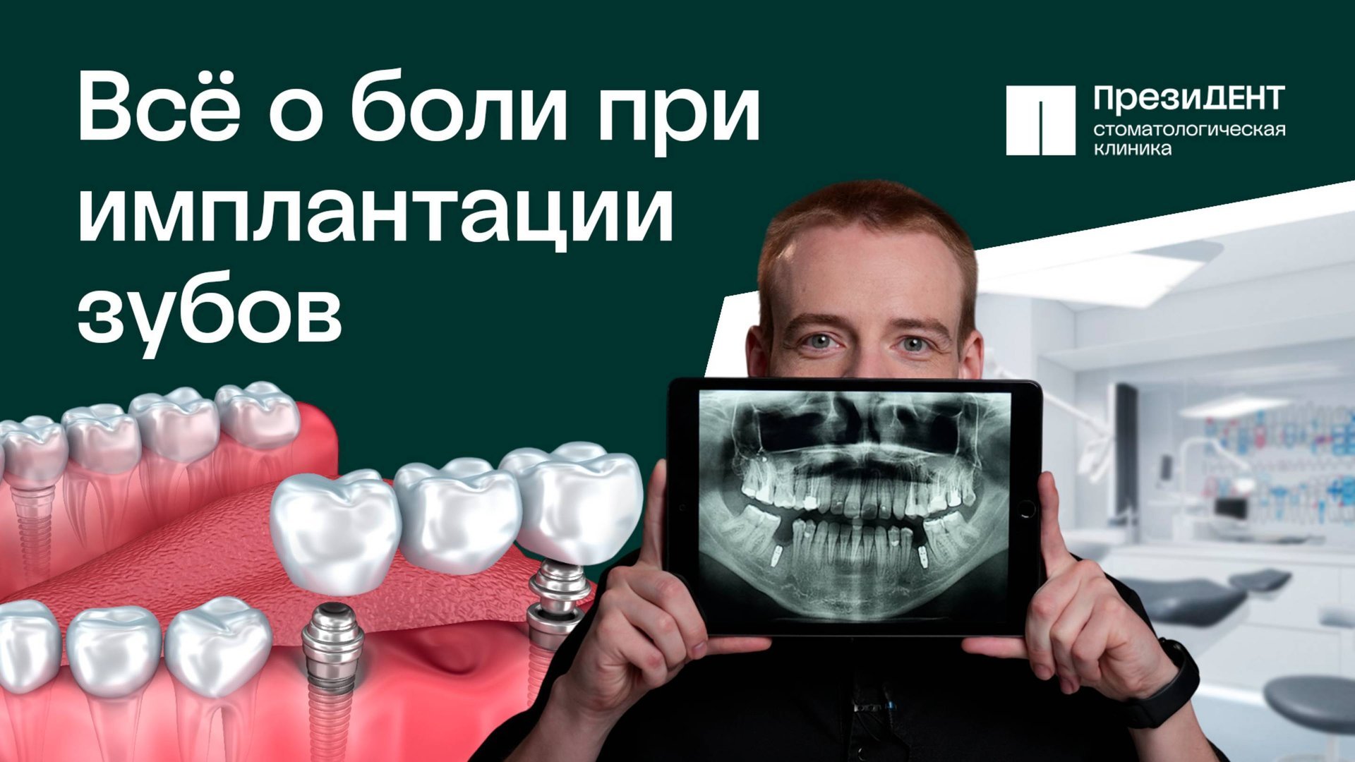 ПРАВДА О БОЛИ ПРИ УСТАНОВКЕ ЗУБНЫХ ИМПЛАНТОВ  🦷 | ПрезиДЕНТ 💚