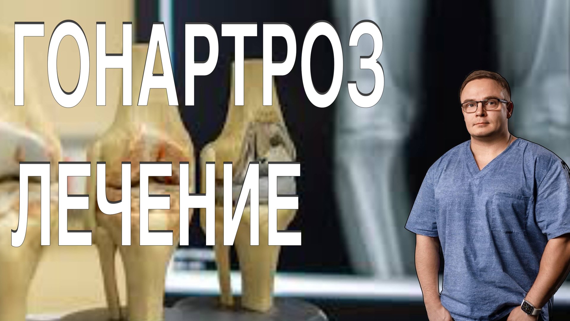 ЛФК при ГОНАРТРОЗЕ | Лечение Коленного Сустава