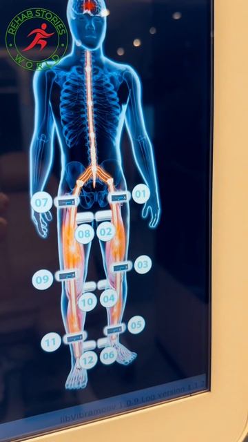 Реабилитация в Индии #АВАР #РехабСторис #Клиника #реабилитация #ВячеславРеут