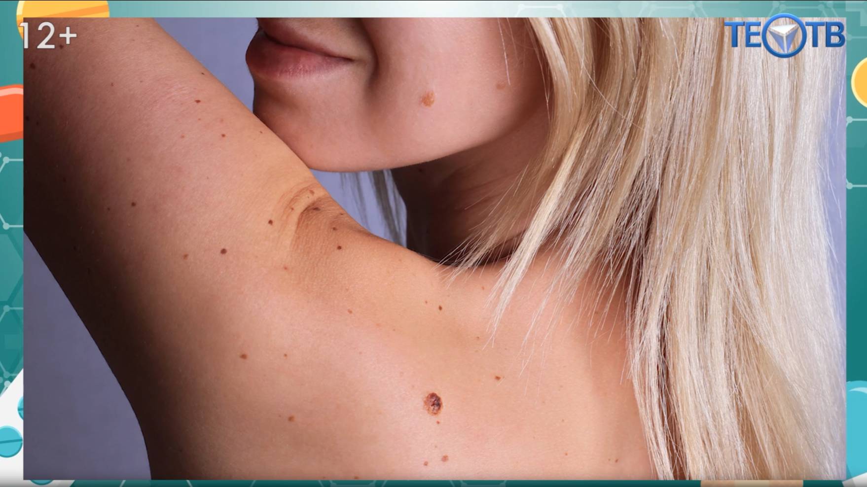 Когда кожа сигналит «SOS»?