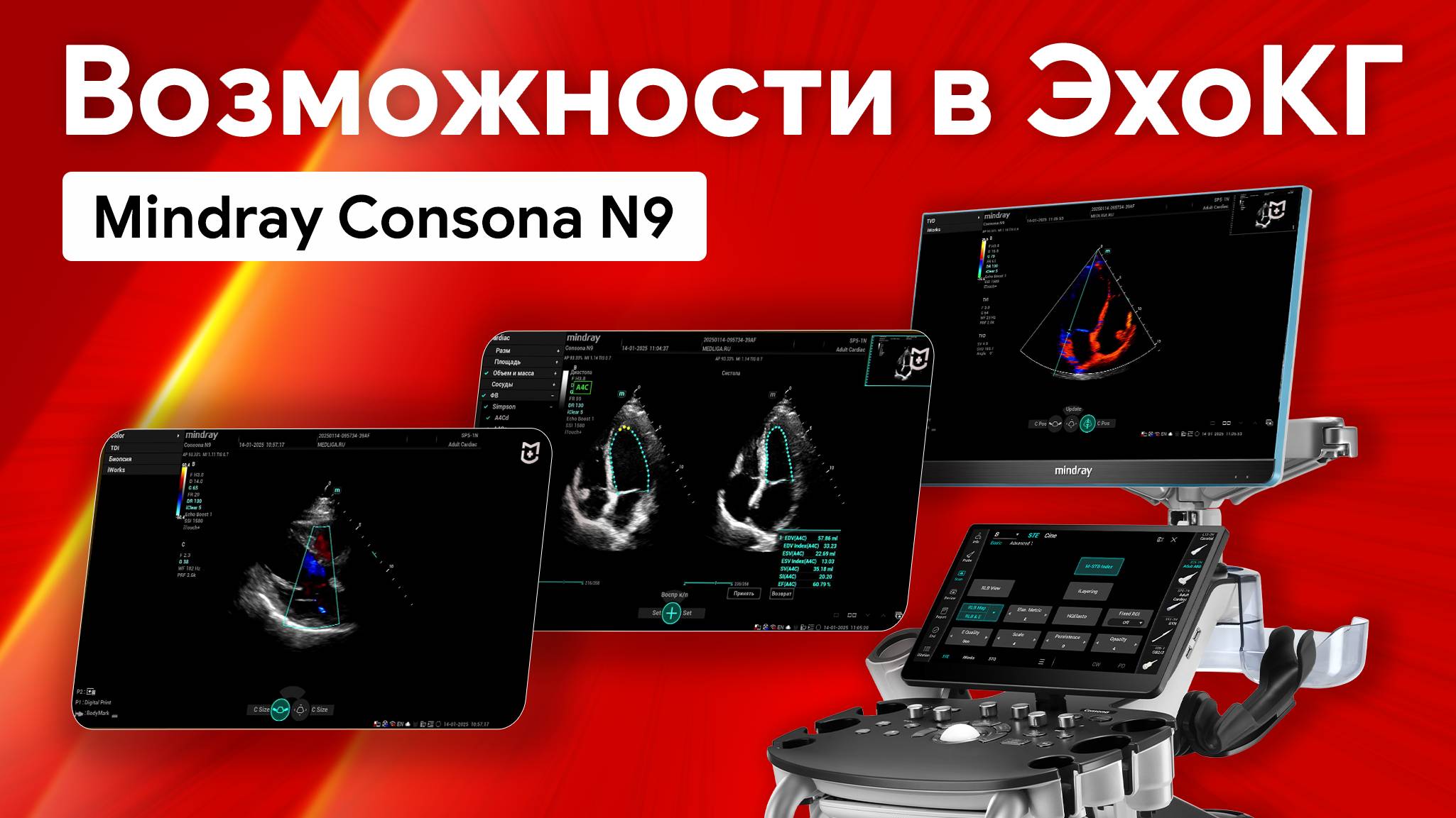 Возможности Mindray Consona N9 в эхокардиографии