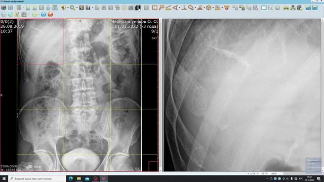 Рабочая станция врача "АрхиМед" и её функции. Часть 2. Окно просмотра изображений.