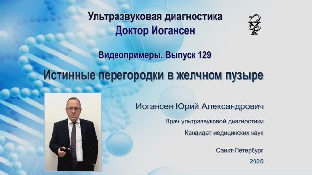 УЗИ. Доктор Иогансен. Видеопримеры. Выпуск 129. Истинные перегородки в желчном пузыре.