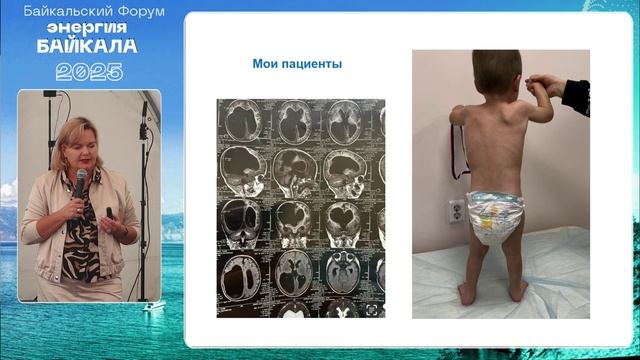 Реабилитация и коллаген: новые вызовы и решения.