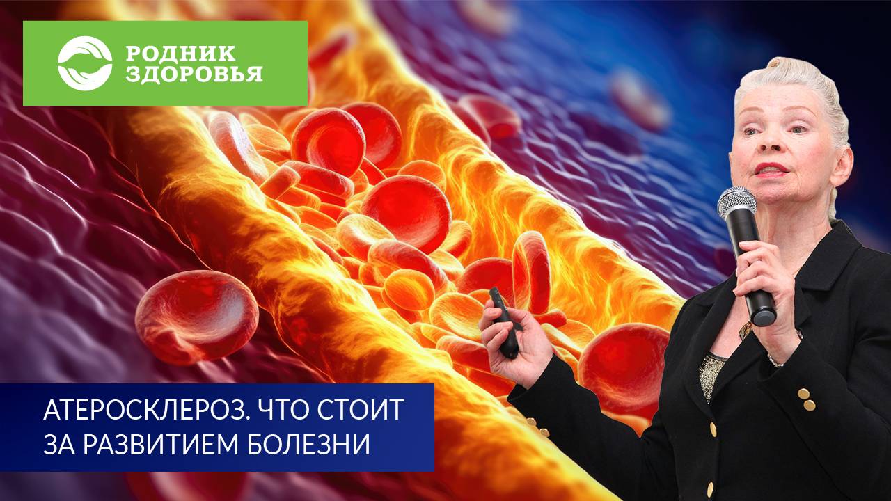 Вебинар Н.Г. Байкуловой "Атеросклероз. Что стоит за развитием болезни?"