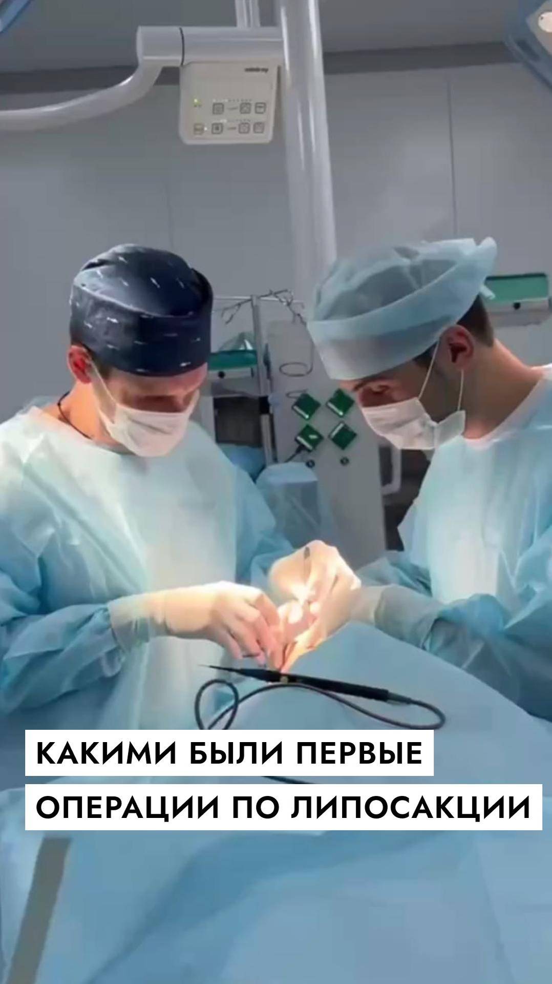 #липосакция: какими были первые операции?