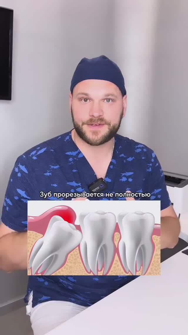 Когда зубы мудрости удалять, а когда лучше оставить?