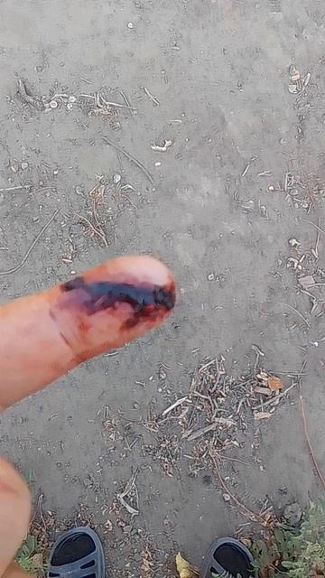 получил травму 🤕