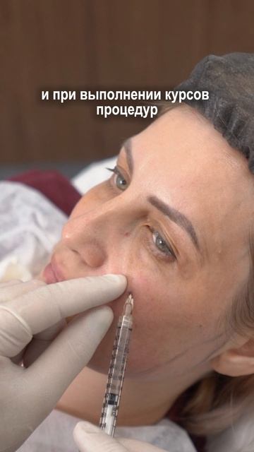 Тёмные круги под глазами исправит Сферогель