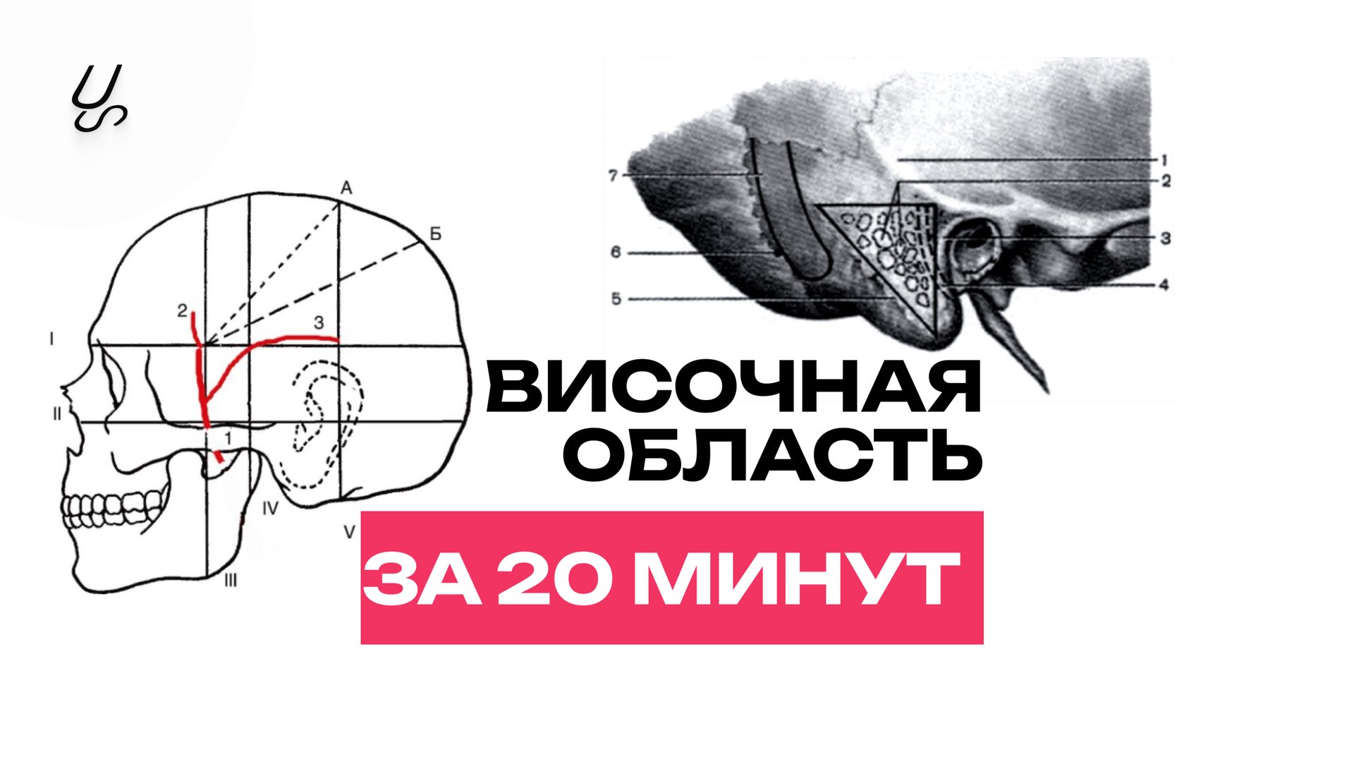 ТА и ОПХ мозгового отдела головы. Височная область