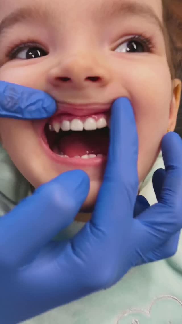 ▶️ Восстановление передних зубов коронками