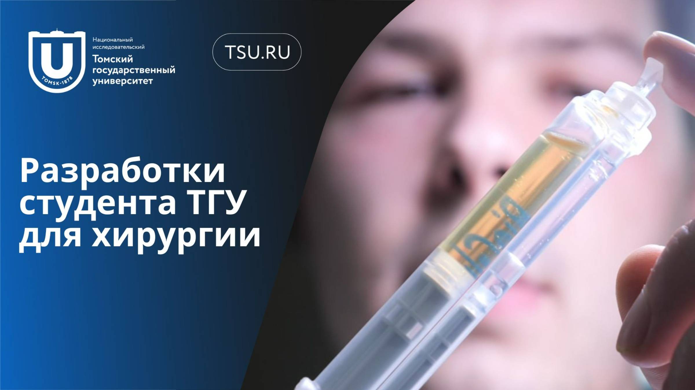 Выпускник ХФ ТГУ создал кровоостанавливающий материал и хирургический клей для медицины