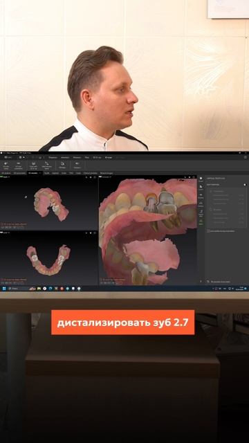 Показываем, как с помощью DTX Studio Clinic можно увидеть истинную патологию еще до начала лечения.