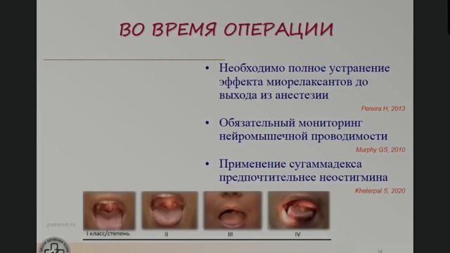 Периоперационное обезболивание у пациентов с сонным апноэ Карелов А.Е