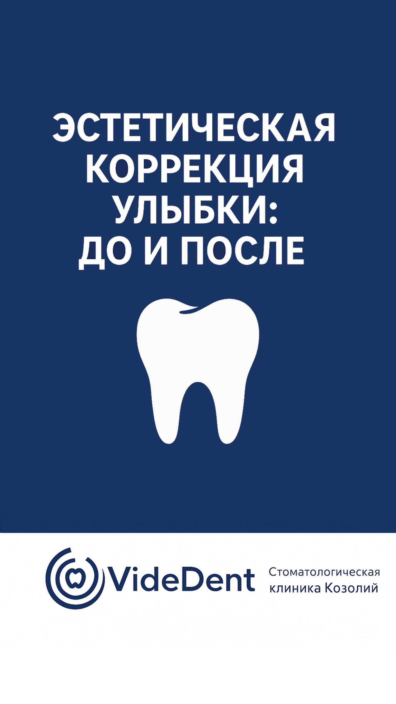 Эстетическая коррекция улыбки: до и после