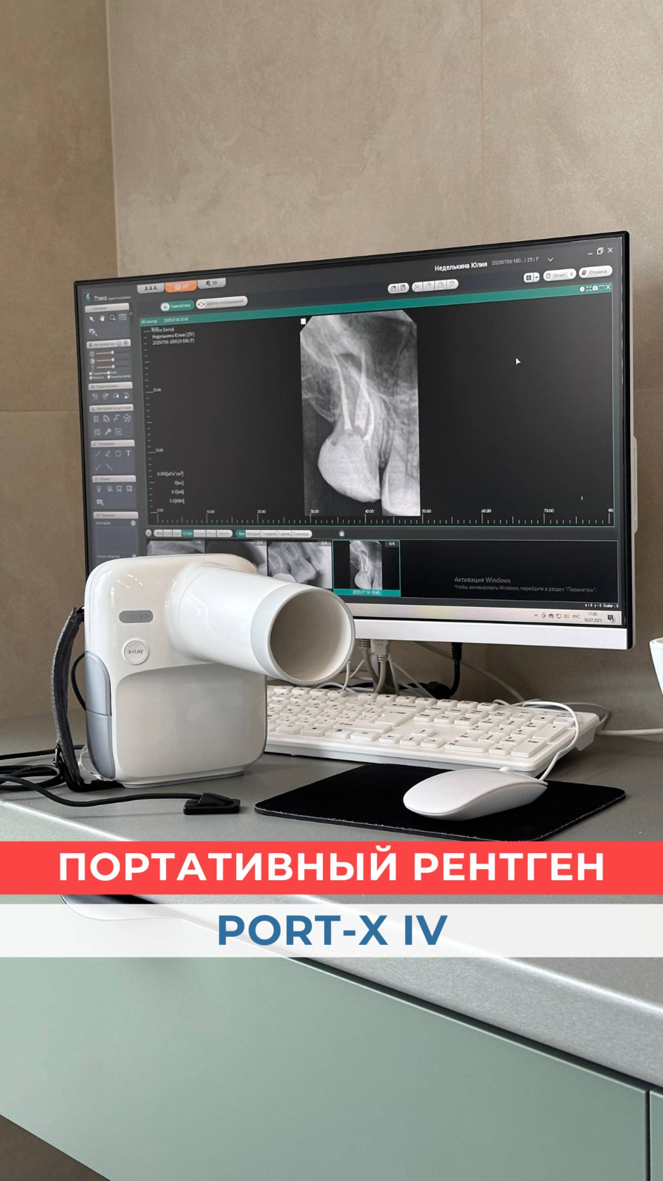 Портативная рентгеновская система визуализации для стоматологии PORT-X 4