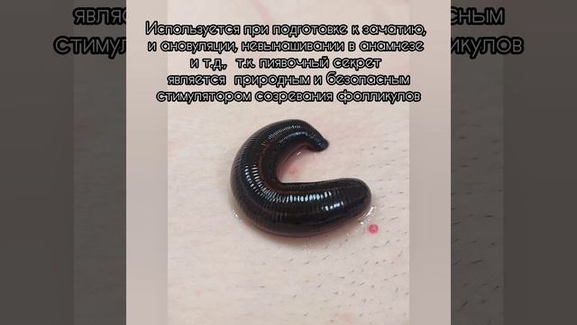 Постановка пиявок на лобок и пах