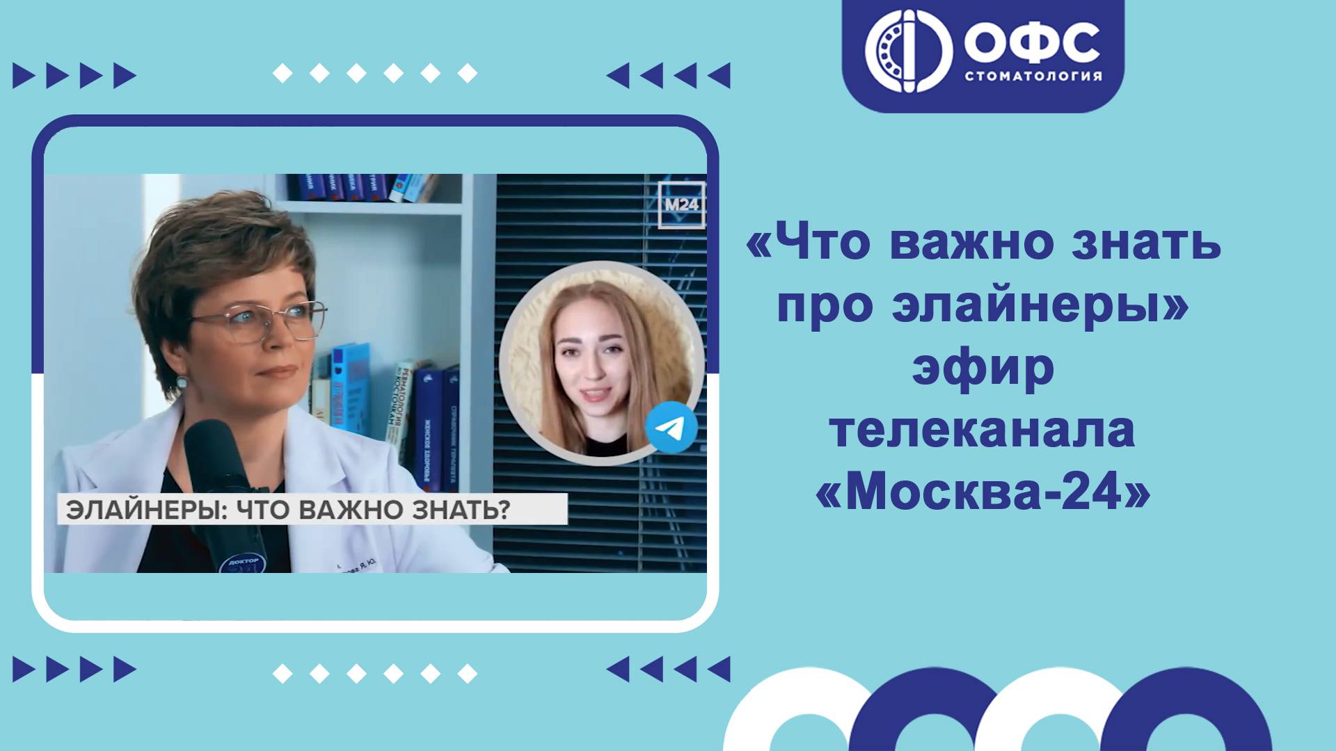 Что важно знать про элайнеры