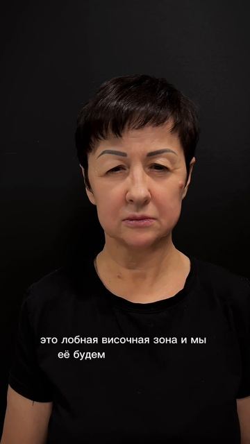 Как проходит подготовка к подтяжке бровей и пластике век