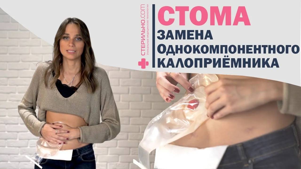 Как заменить однокомпонентный калоприемник | Стерильно.com 4К