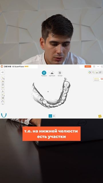 Клинический случай от Игоря Горшилина: работа с концевыми дефектами.