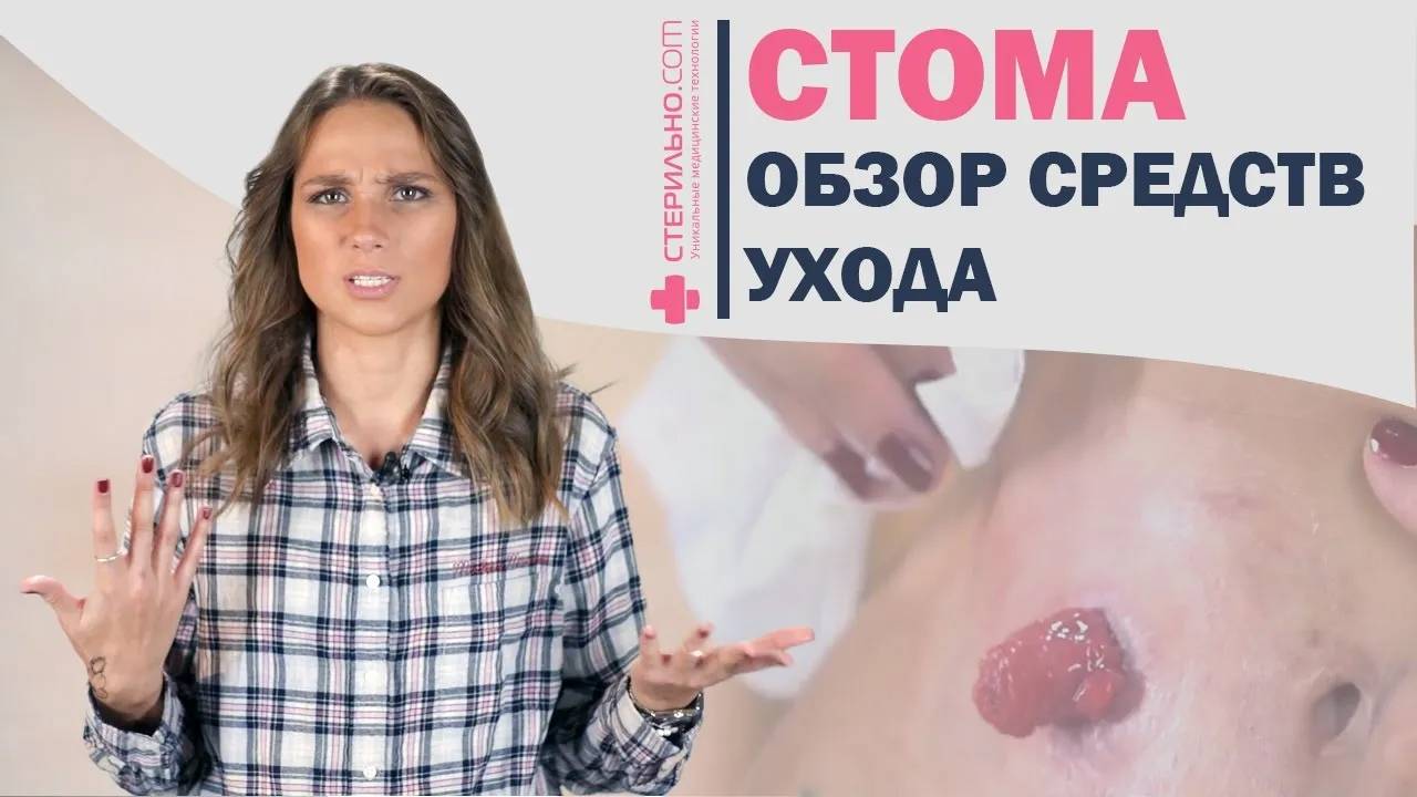 Обзор средств по уходу за кишечной стомой   | Стерильно.com 4К
