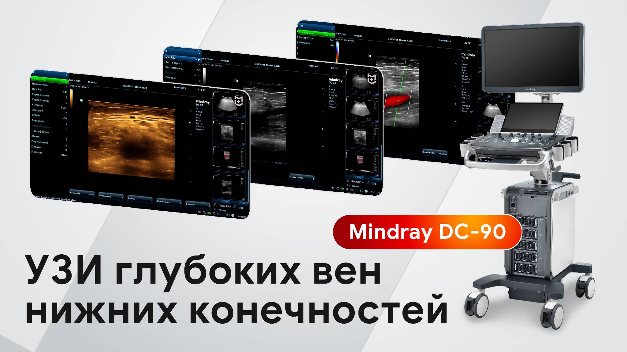 Мастер-класс по УЗИ глубоких вен нижних конечностей на Mindray DC-90