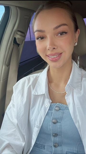 Отзыв пациентки о ринопластике, спустя 1,5 года после операции