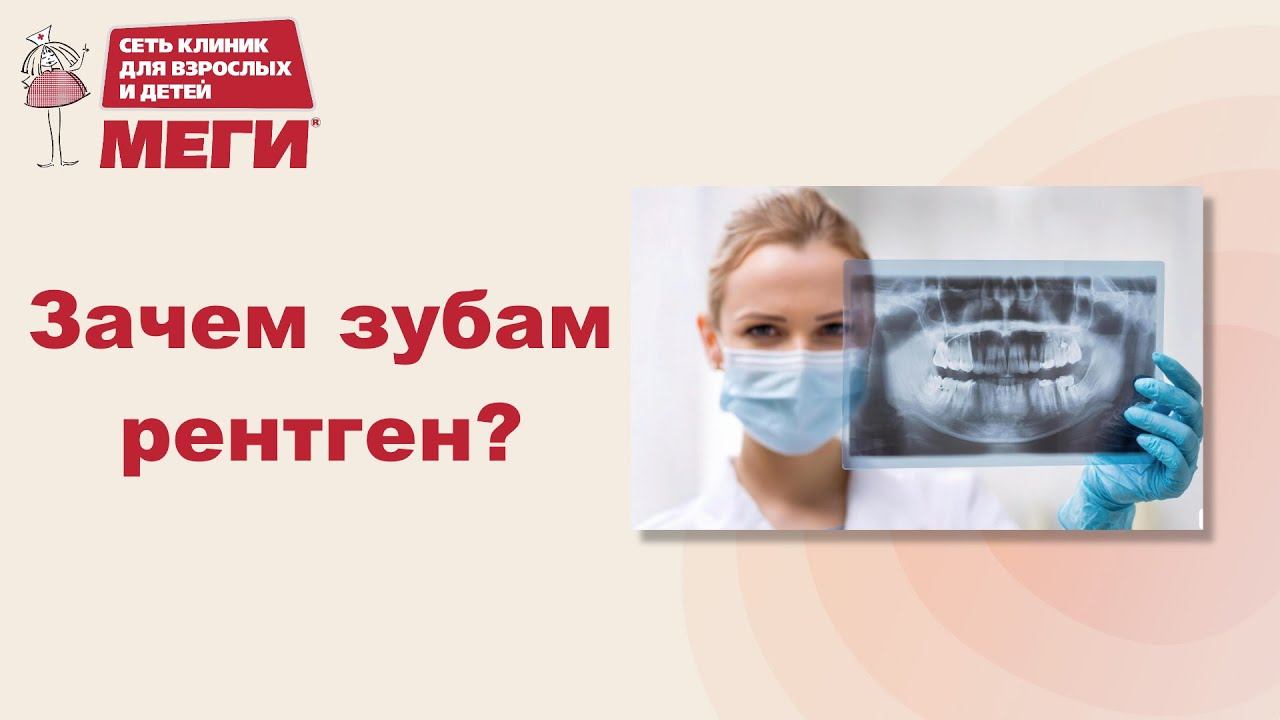 Какое облучение на зубном рентгене?