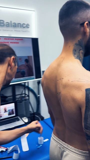 Кинезиотейпирование в реабилитации. Динамическое постуральное Тейпирование. Поезда Майерса