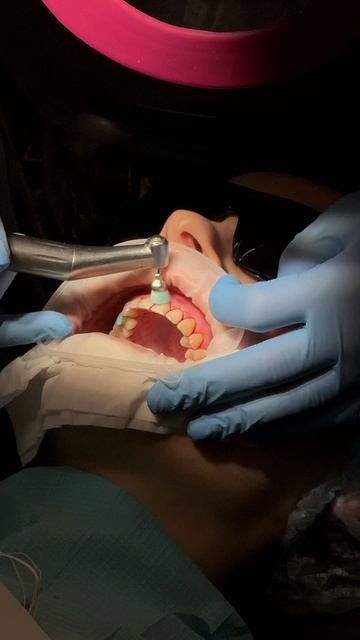 Профессиональная гигиена полости рта