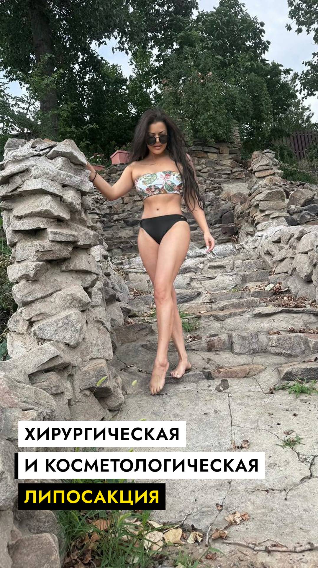 Хирургическая и косметическая липосакция: что лучше?