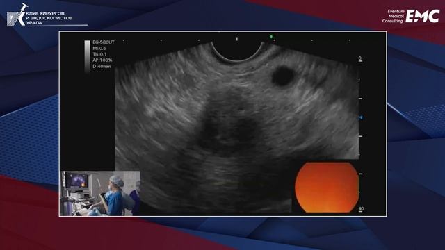 Включение из операционной