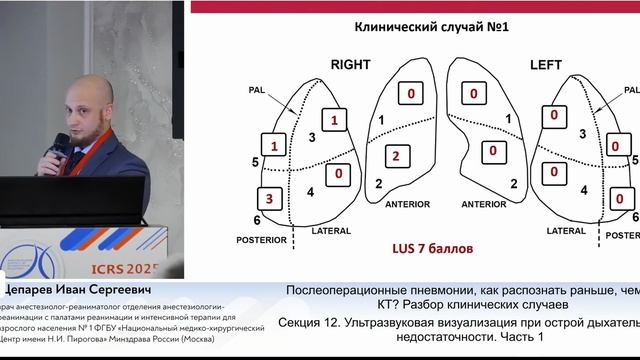 Послеоперационные пневмонии по УЗИ  Щепарев И.С.