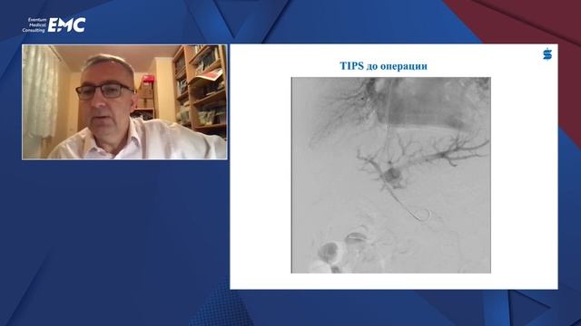 Доклад «Механическая желтуха у больных хроническим панкреатитом и опухолями поджелудочной железы»