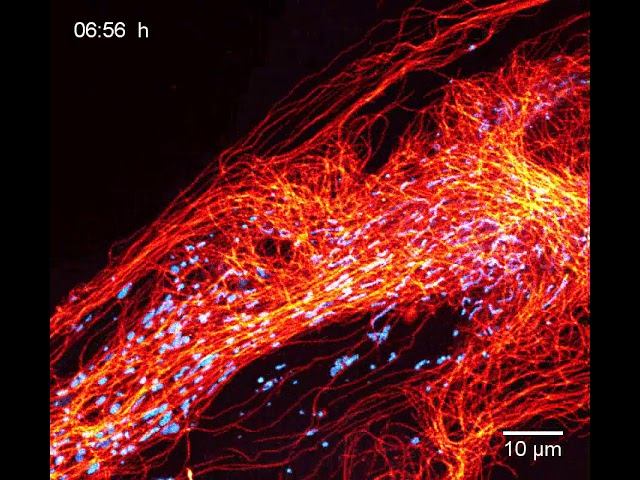 Конфокальная съемка живых клеток с функцией STEADYFOCUS