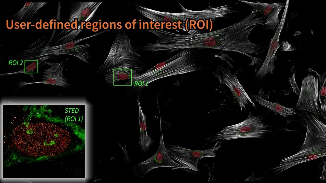 Многопозиционная STED визуализация с помощью STEDYCON