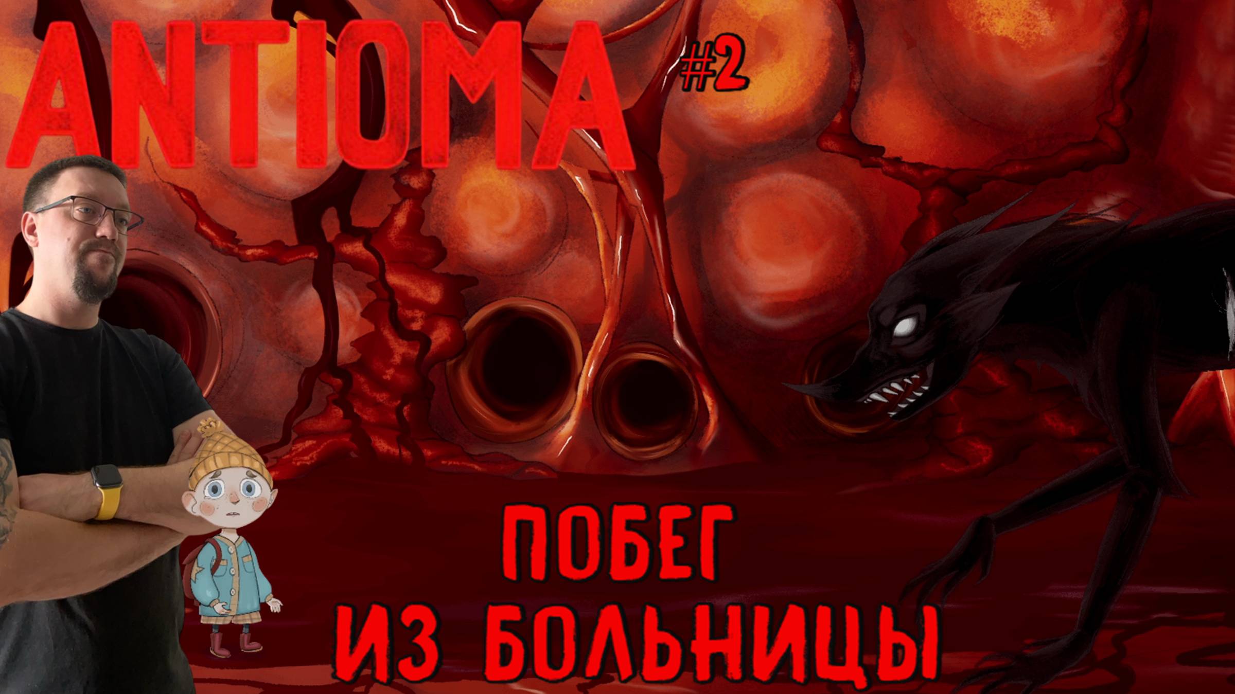 Побег из больницы / #Antioma / Серия 2