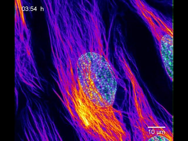 Конфокальная съемка живых клеток с функцией STEADYFOCUS