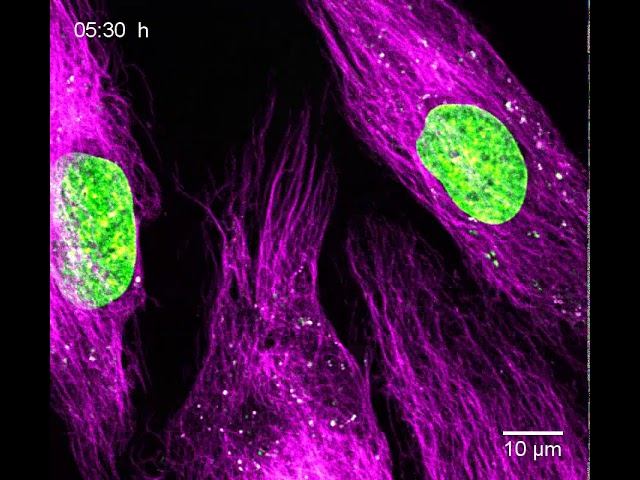 Конфокальная съемка живых клеток с функцией STEADYFOCUS