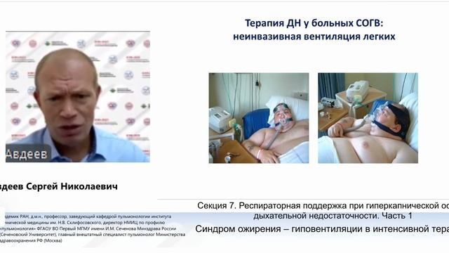 Синдром ожирения – гиповентиляции в интенсивной терапии Авдеев С.Н.