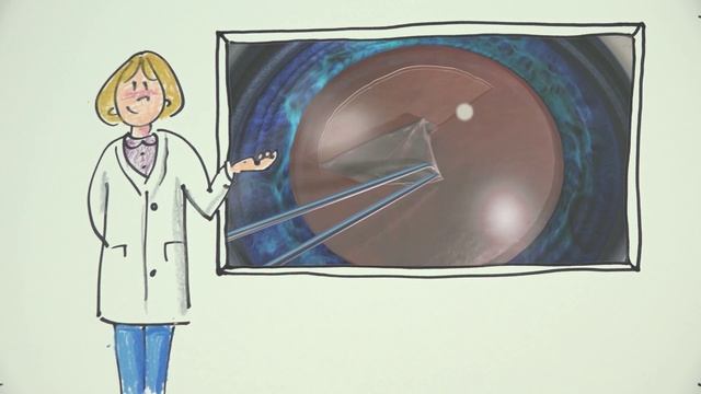 Операция от А до Я