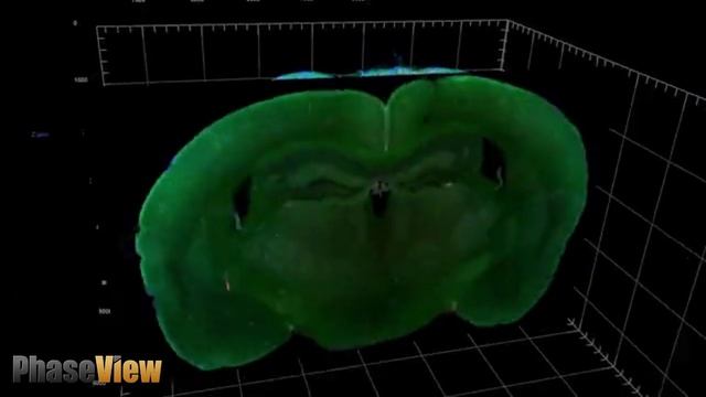 3D микроскопия биологических образцов