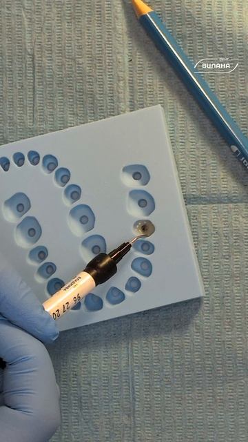 Силиконовый шаблон для изготовления индивидуальных формирователей десны пока пациент в кресле.