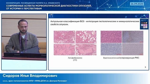 Саркомы. Эволюция взглядов - Сидоров И.В.