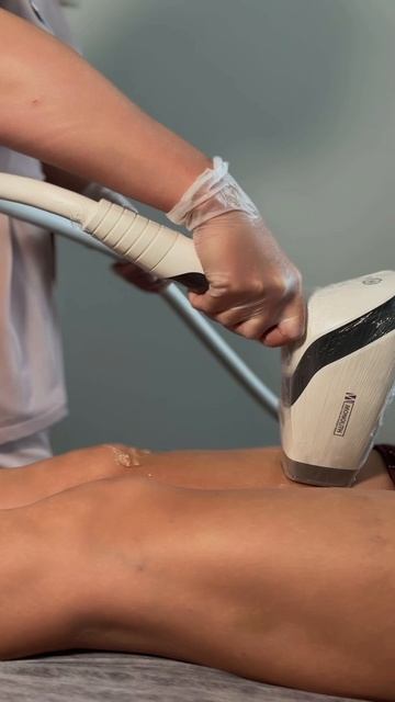 Диодная и Александритовая лазерная эпиляция