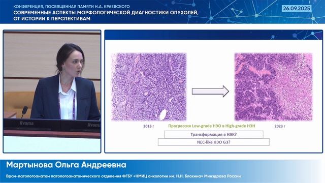 High-grade трансформация в нейроэндокринных неоплазиях - Мартынова О.А.