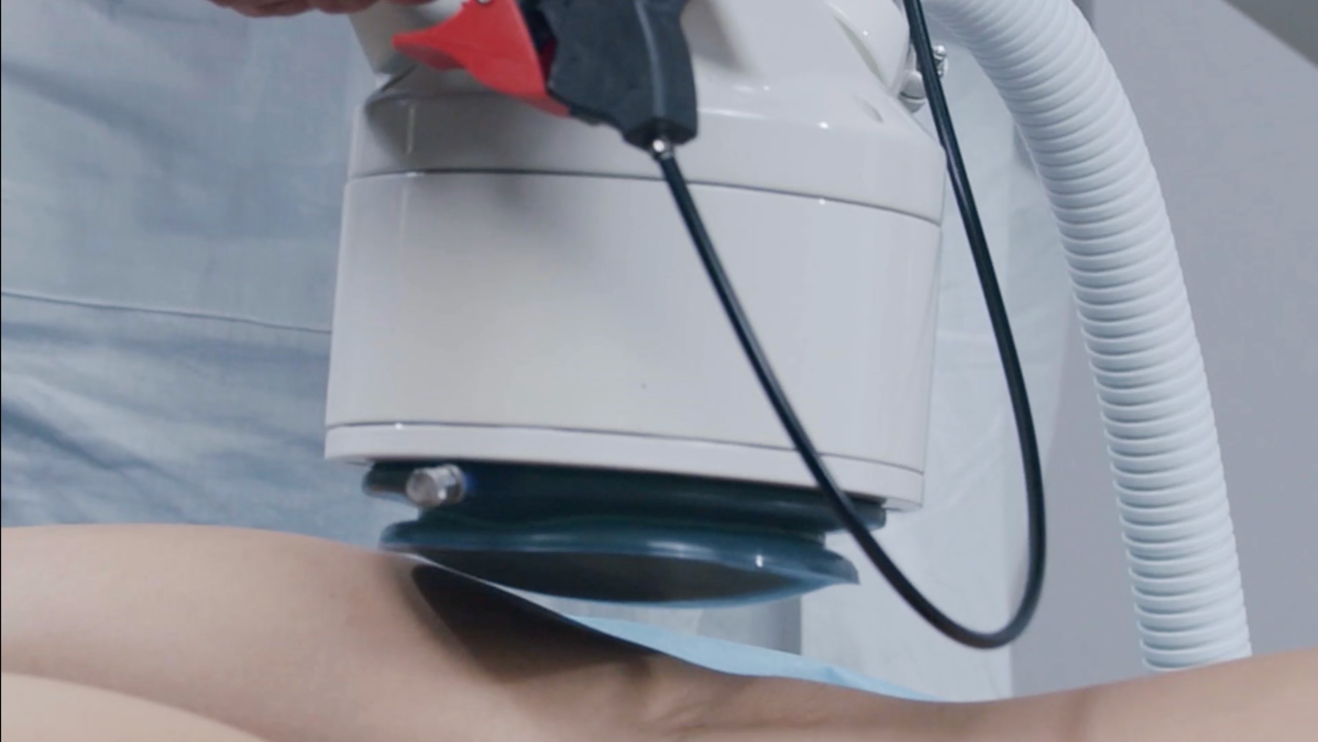 Лечим боль под коленом – эффект после первой процедуры. Работа на ЭУВТ МЕДОЛИТ-ТМ